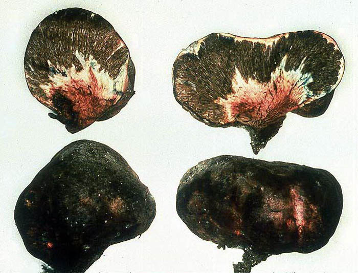 Gastroid and Truffle Fungi